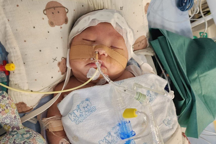 Month-old baby with heart defect had 2 strokes, 2 ops; parents raising ...